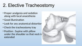 TRACHEOSTOMY, indication and management.pptx