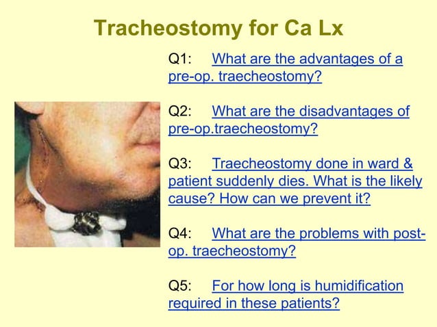 Tracheostomy for PG students | PPT
