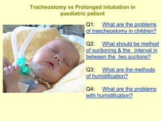Tracheostomy for PG students | PPT