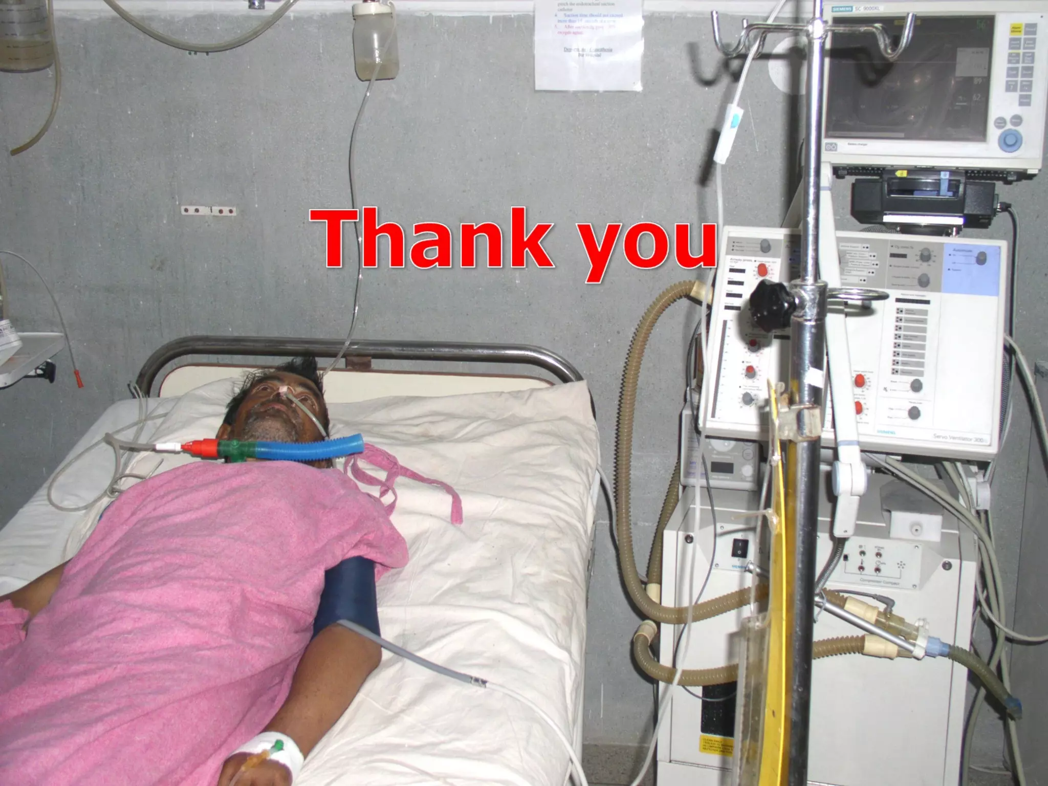 The Role of Early Tracheostomy in Severe Head Injuries - Dr. Rajiv Jha ...