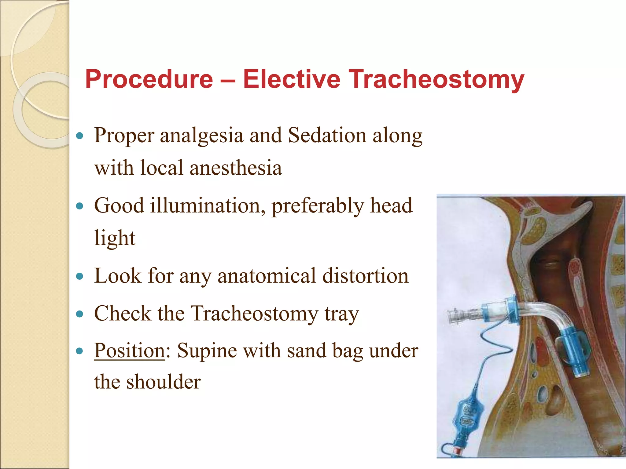 Tracheostomy | PPT