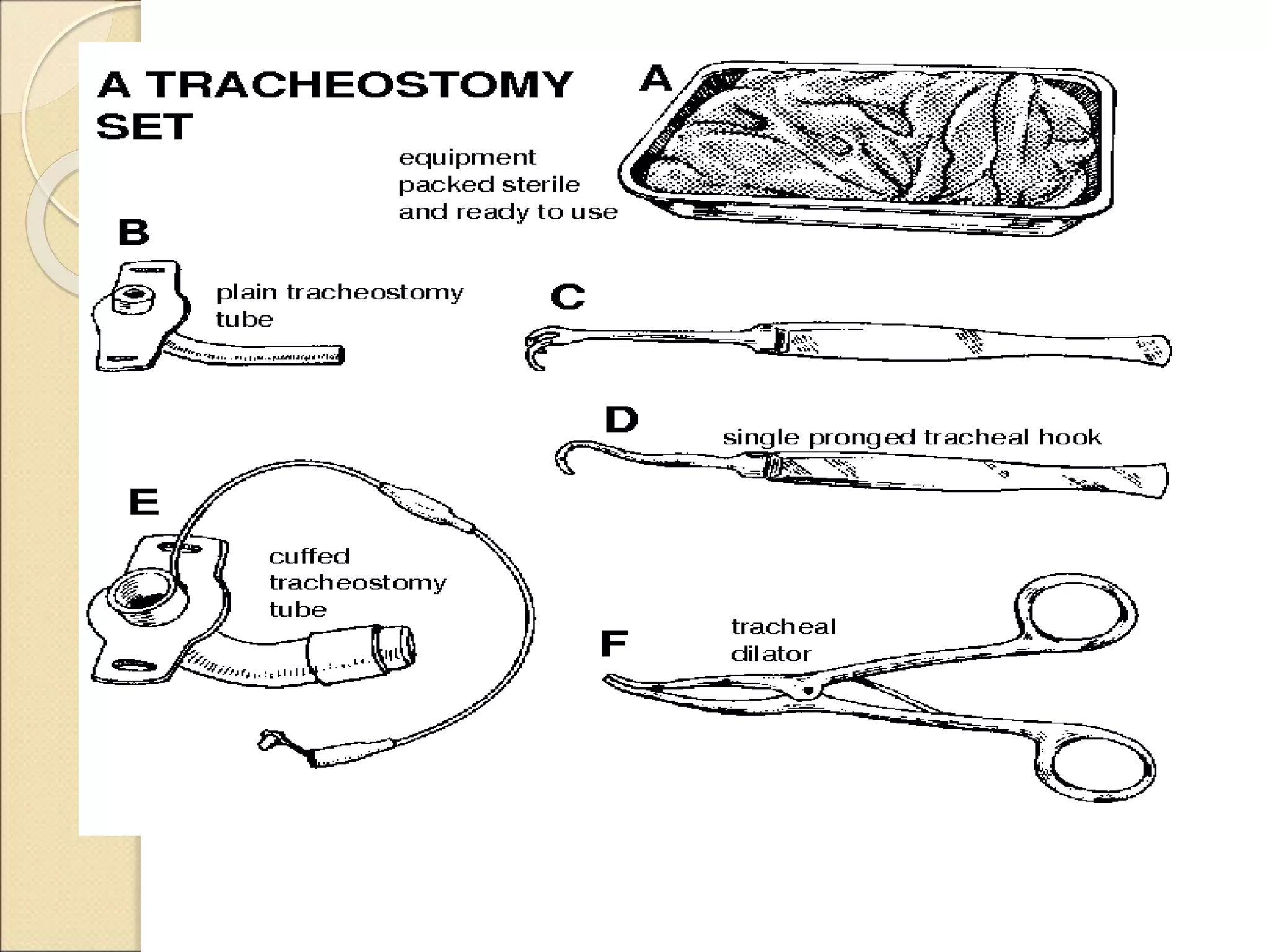 Tracheostomy | PPT