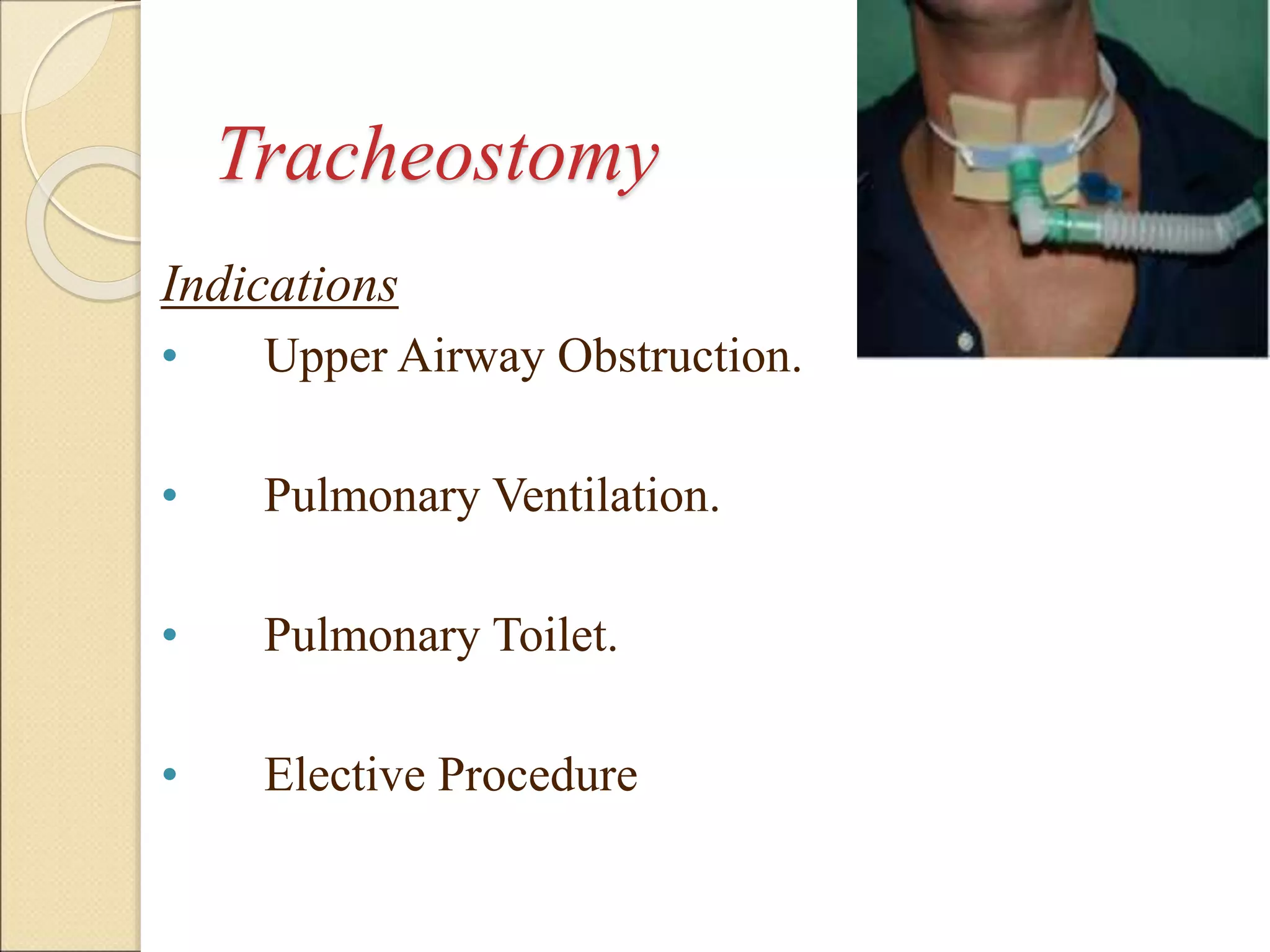 Tracheostomy | PPT