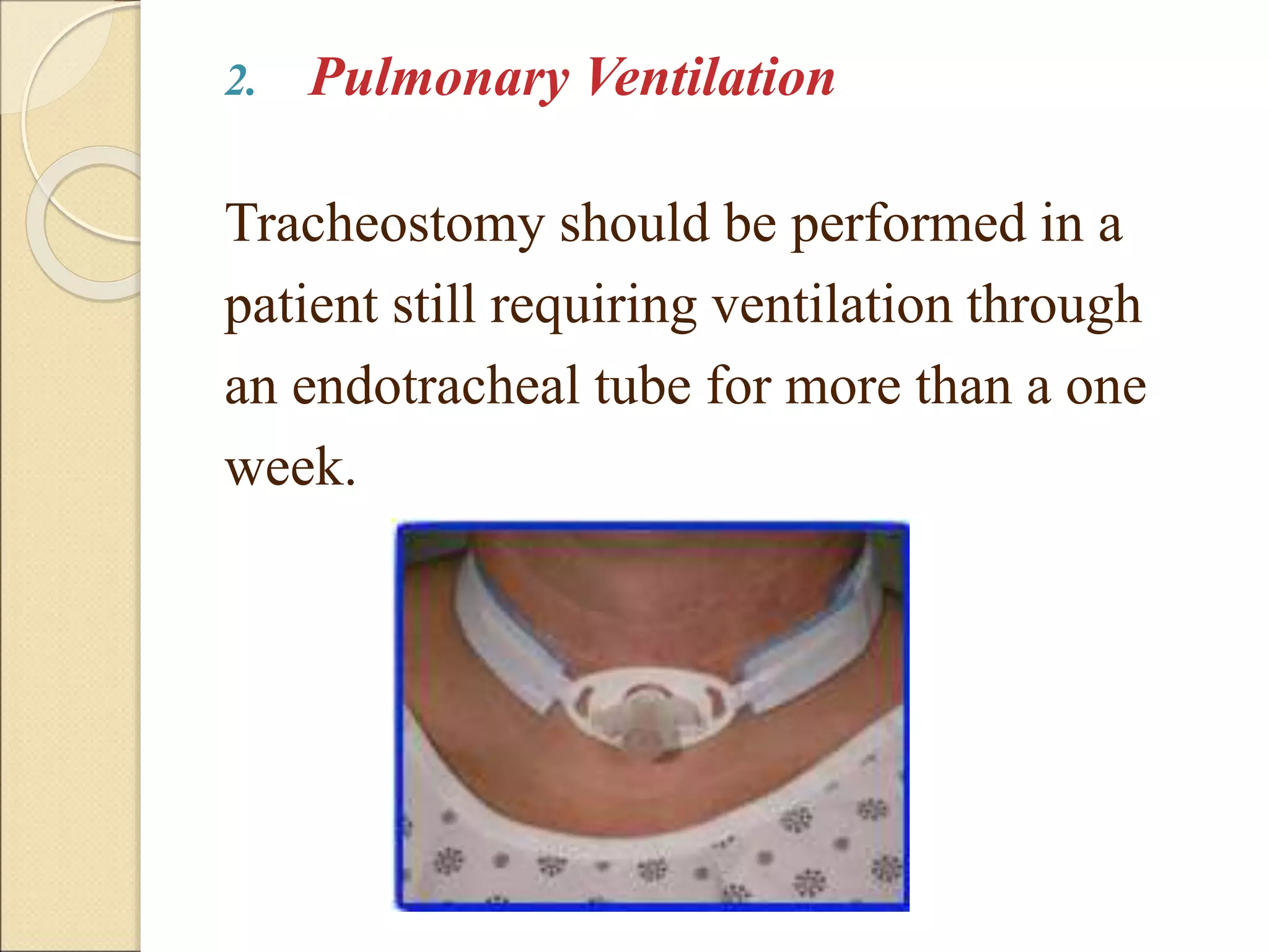 Tracheostomy | PPT