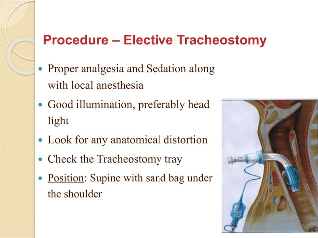 Tracheostomy | PPT | First Aid | Injuries