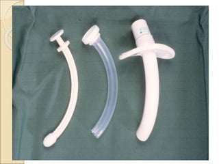 Tracheostomy | PPT