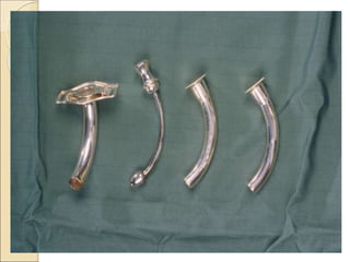 Tracheostomy | PPT