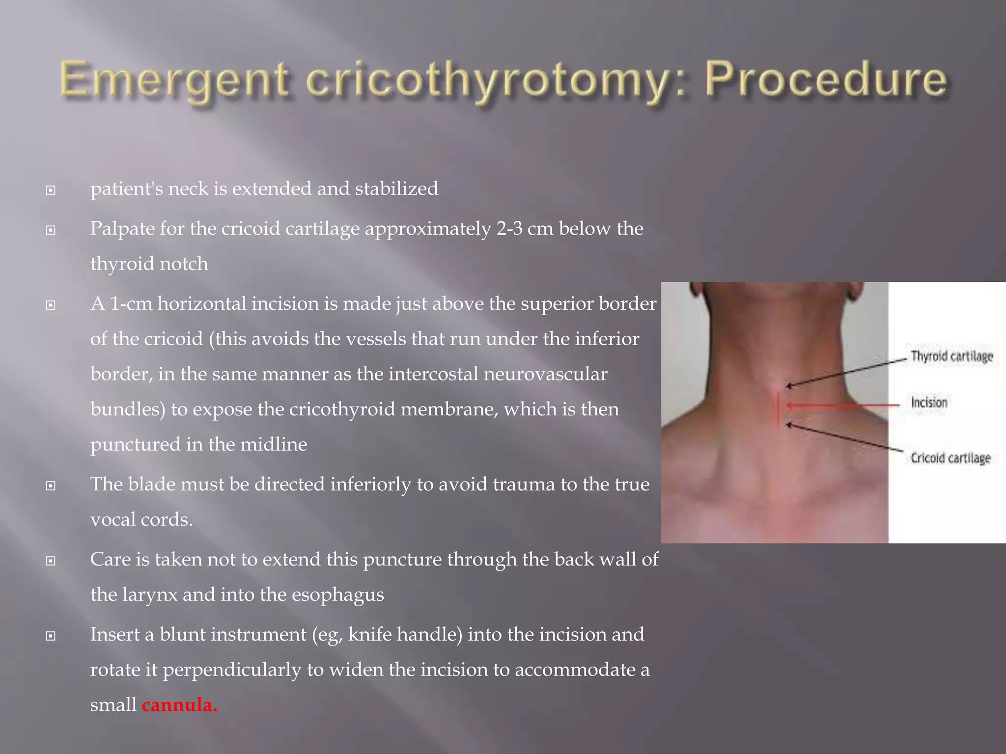 Tracheostomy Final.pptx | Ear, Nose and Throat Conditions | Diseases ...