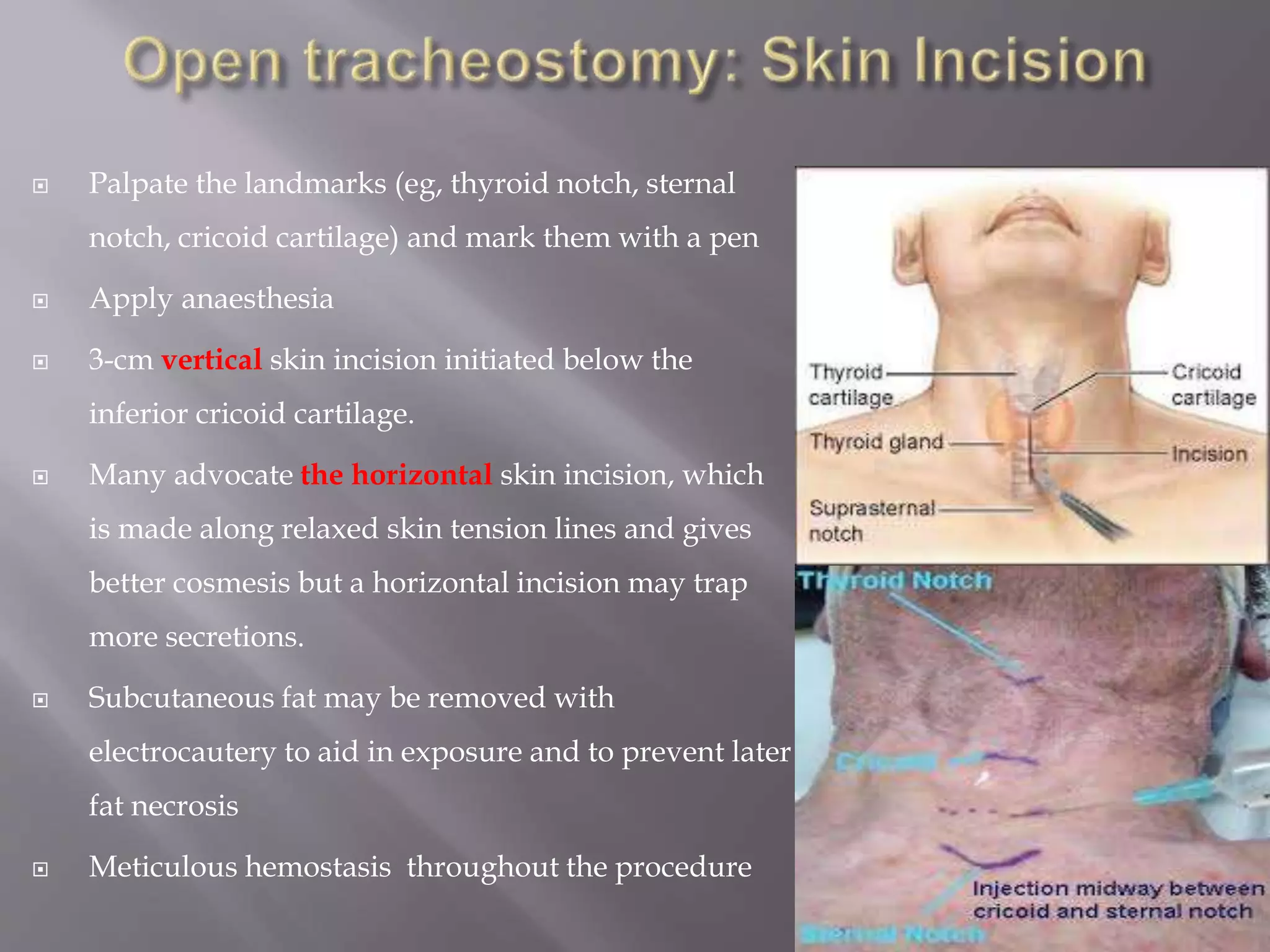 Tracheostomy Final.pptx | Ear, Nose and Throat Conditions | Diseases ...