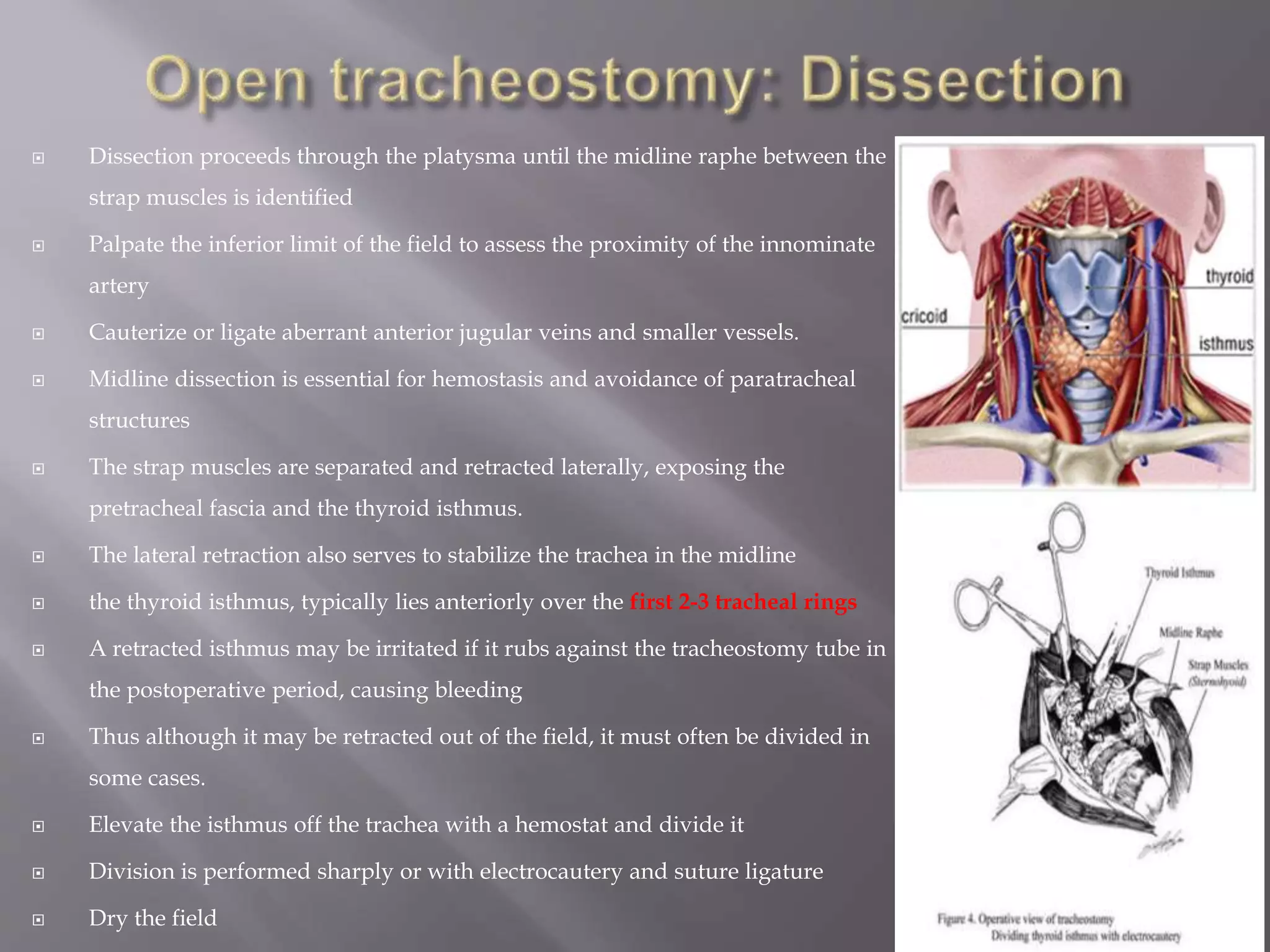 Tracheostomy Final.pptx | Ear, Nose and Throat Conditions | Diseases and Conditions