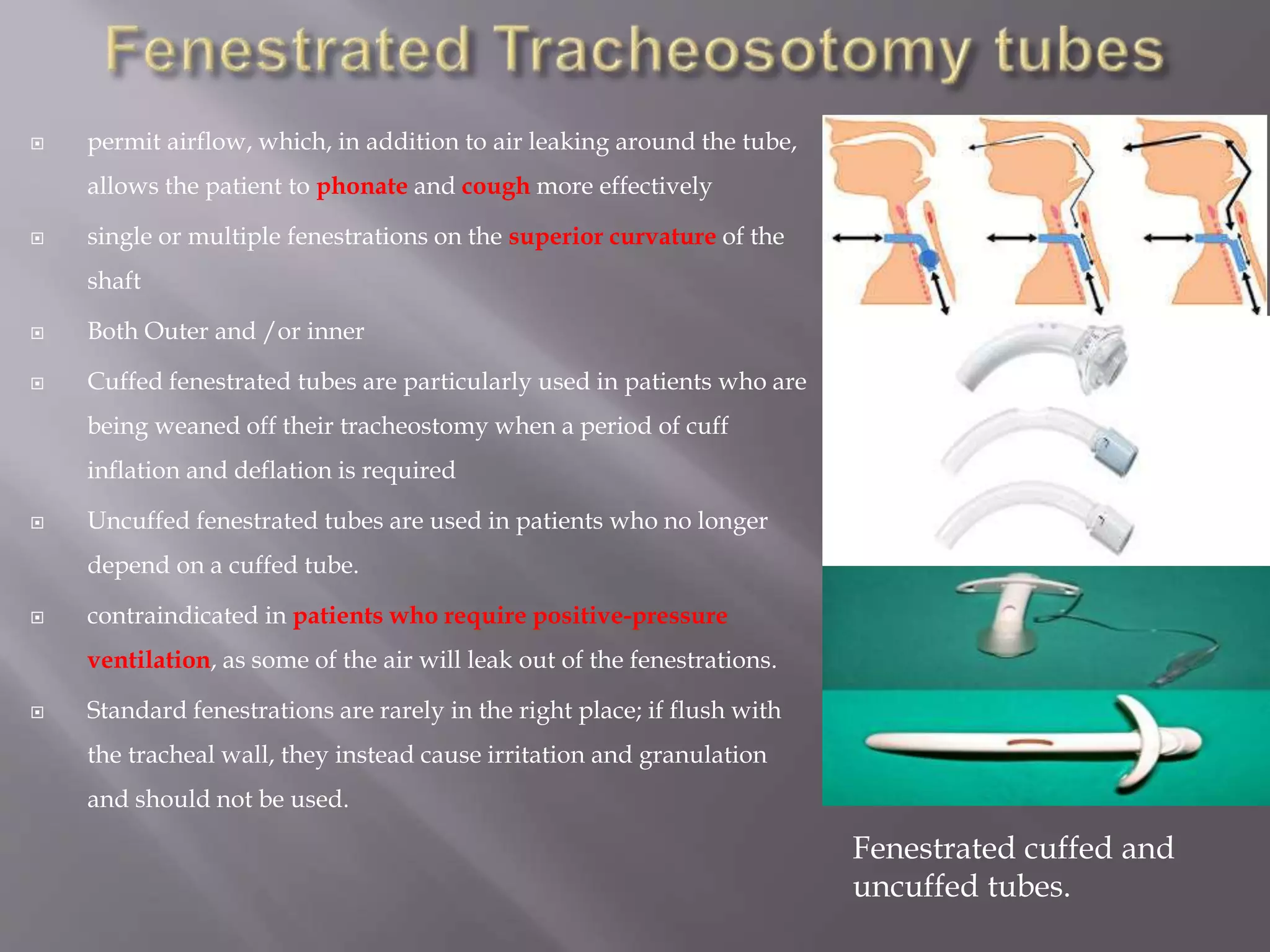 Tracheostomy Final.pptx | Ear, Nose and Throat Conditions | Diseases and Conditions