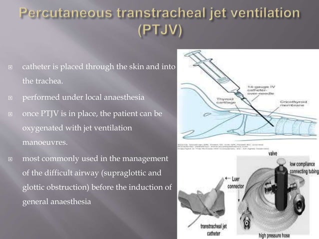 Tracheostomy Final.pptx | Ear, Nose and Throat Conditions | Diseases ...
