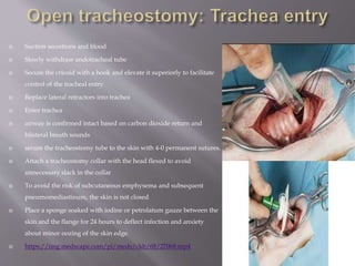 Tracheostomy Final.pptx