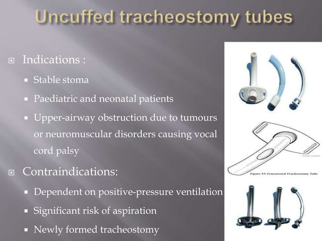 Tracheostomy Final.pptx | Ear, Nose and Throat Conditions | Diseases ...