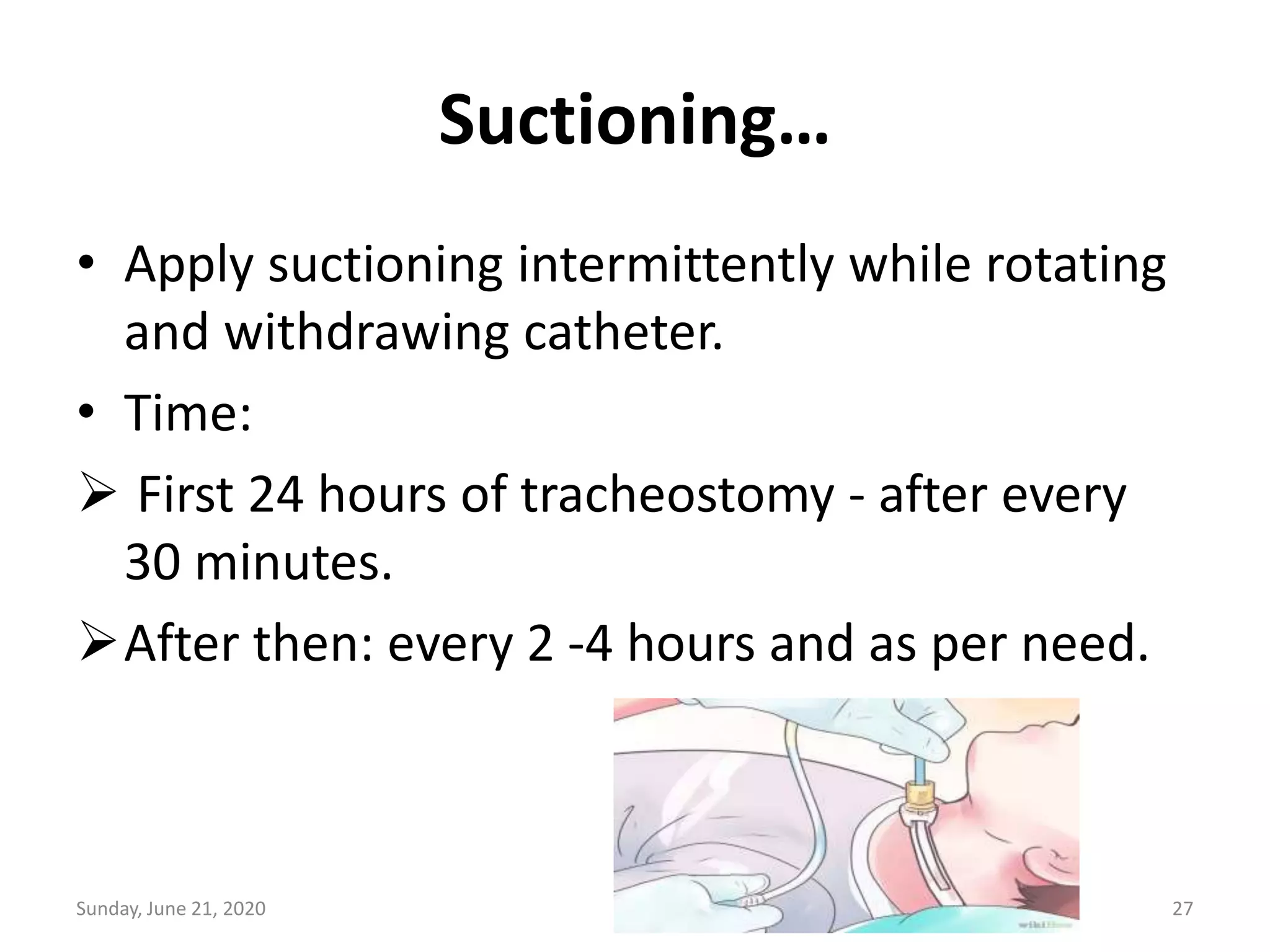 Tracheostomy and its care | PPTX