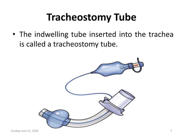 Tracheostomy and its care | PPTX