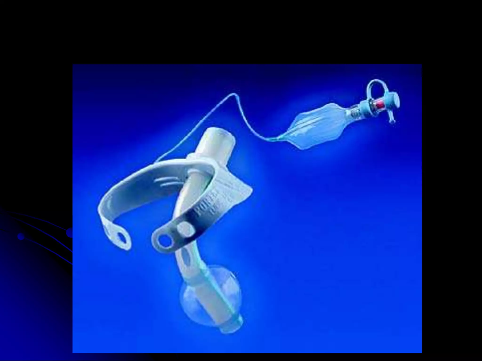 Tracheostomy care | PPT