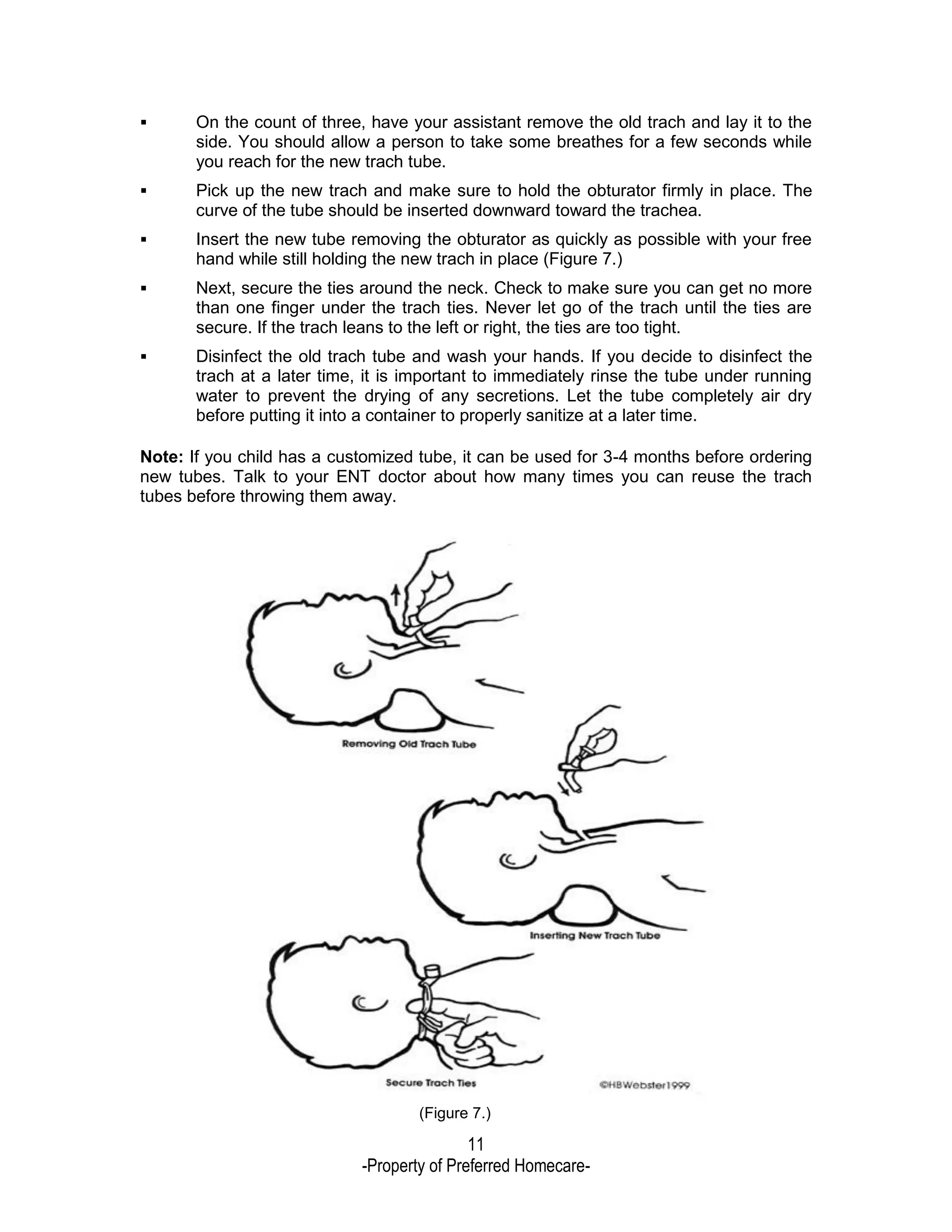 Tracheostomy home care guidelines | PDF