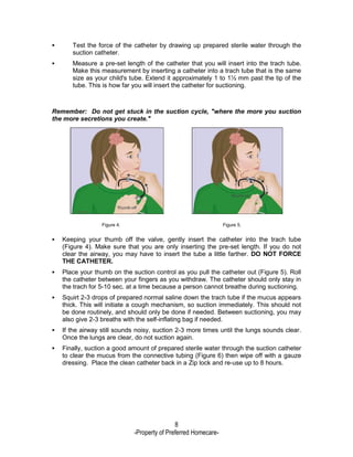 Tracheostomy home care guidelines | PDF