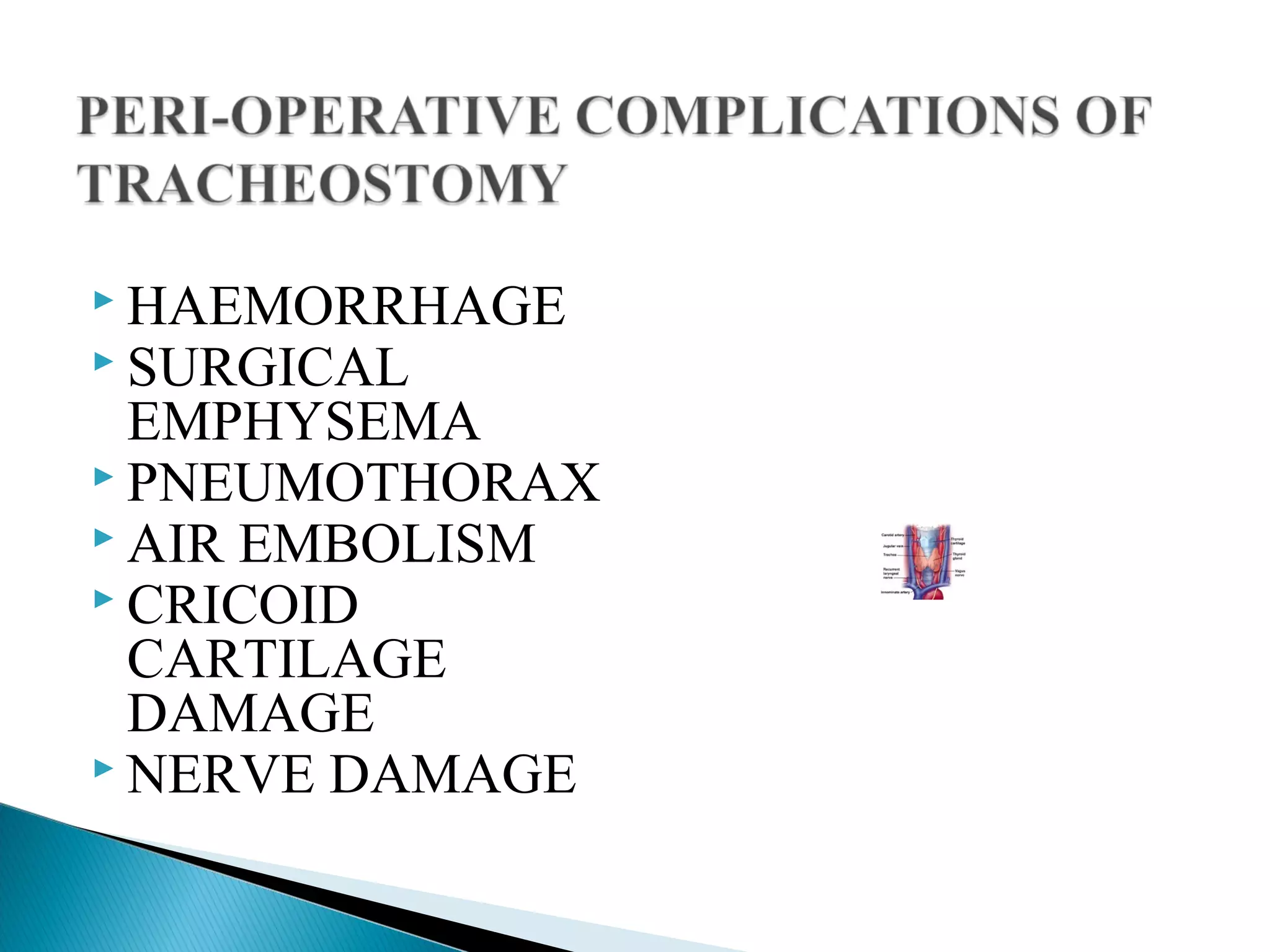 Tracheostomy john | PPT