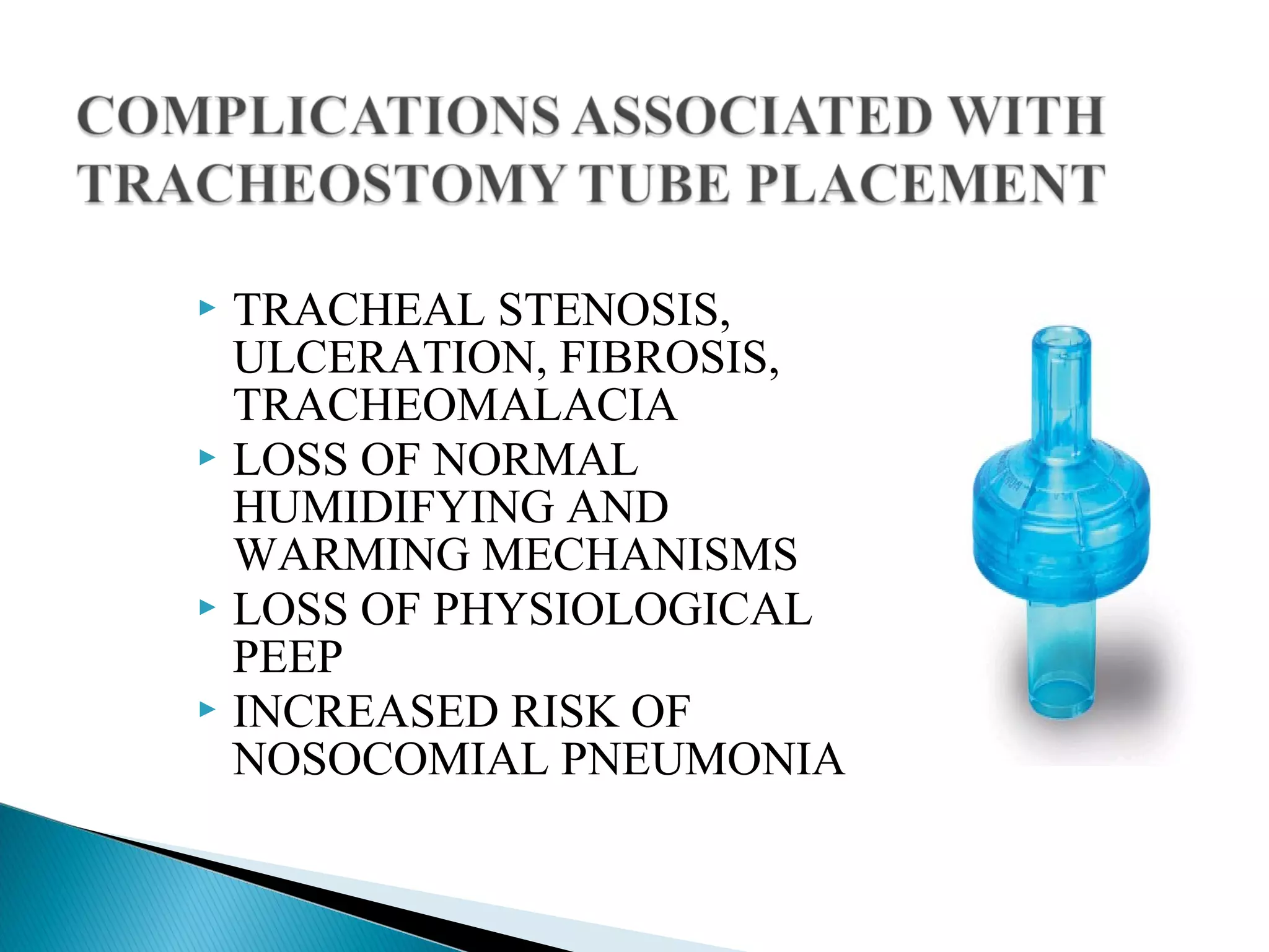 Tracheostomy john | PPT