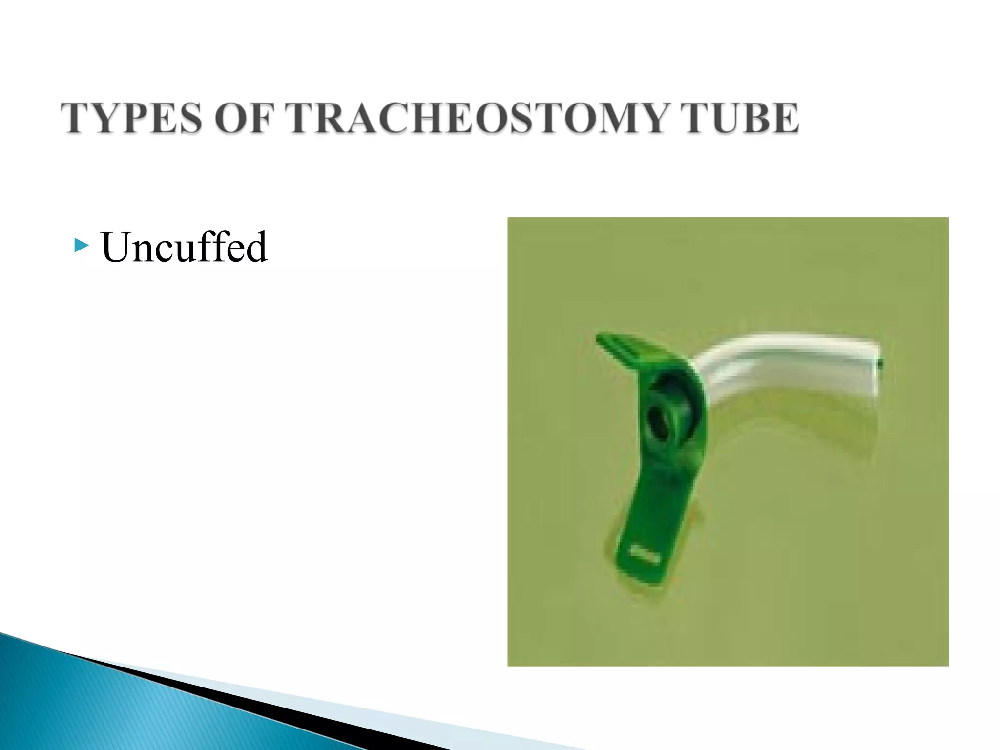 Tracheostomy john | PPT