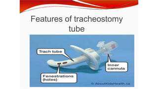 tracheostomy new.pptx by professor Dr Ahmed Al Abbasi | PPTX