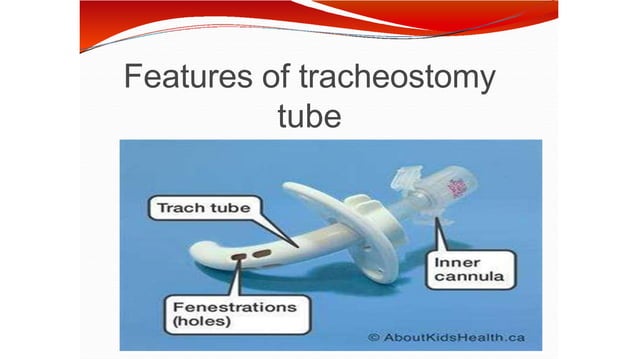 tracheostomy new.pptx by professor Dr Ahmed Al Abbasi | PPTX | Ear ...