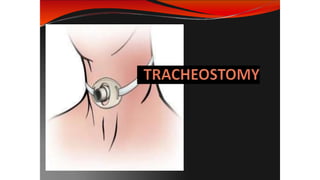 tracheostomy new.pptx by professor Dr Ahmed Al Abbasi | PPT
