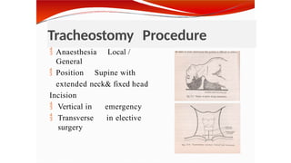 tracheostomy new (2).power point presentation | PPTX