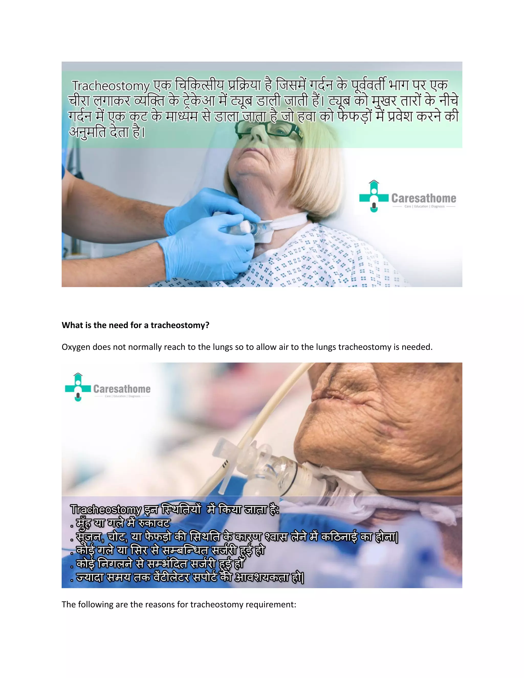 All about Tracheostomy care at home | PDF