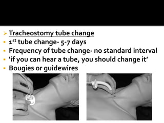 Tracheostomy ppt | PPTX