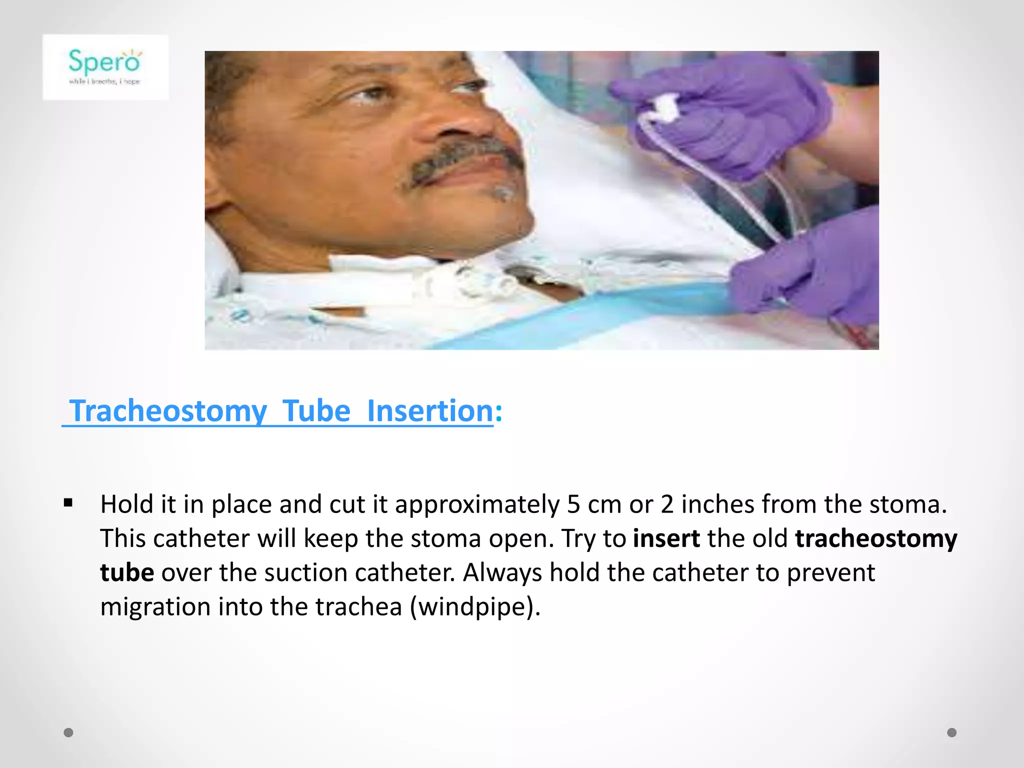 Tracheostomy removal and replacement | PPTX | Lung and Respiratory ...