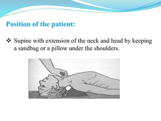TRACHEOSTOMY SEMINAR.pptx