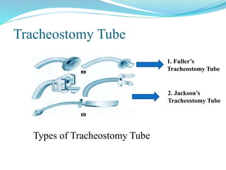 TRACHEOSTOMY SEMINAR.pptx