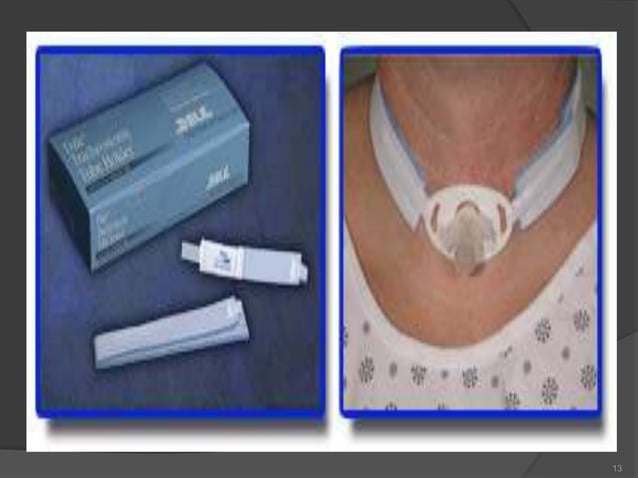 Tracheostomy site care procedure | PPTX | First Aid | Injuries