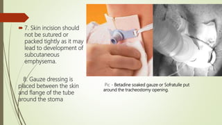 Tracheostomy & tracheal surgeries | PPTX