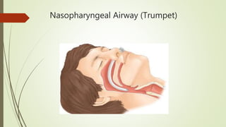 Tracheostomy & tracheal surgeries | PPTX