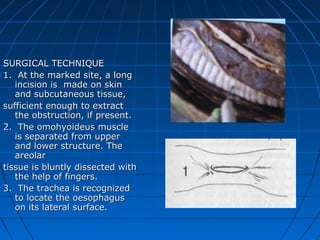 Tracheotomy, By Dr. Rekha Pathak, Senior scientist IVRI | PPT