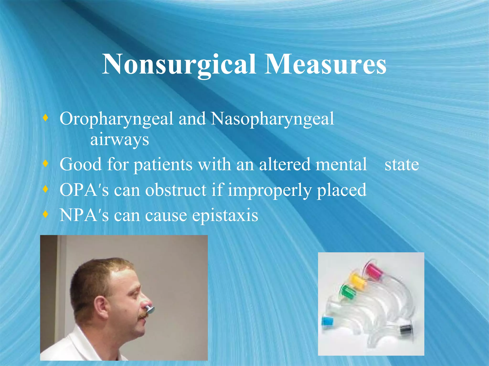 Tracheotomy - UCLA Head and Neck Surgery, ENT Ear, Nose & Throat ...