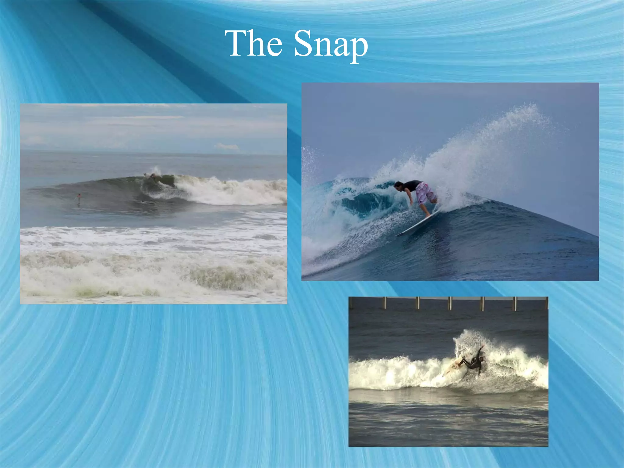 Tracheotomy - UCLA Head and Neck Surgery, ENT Ear, Nose & Throat ...