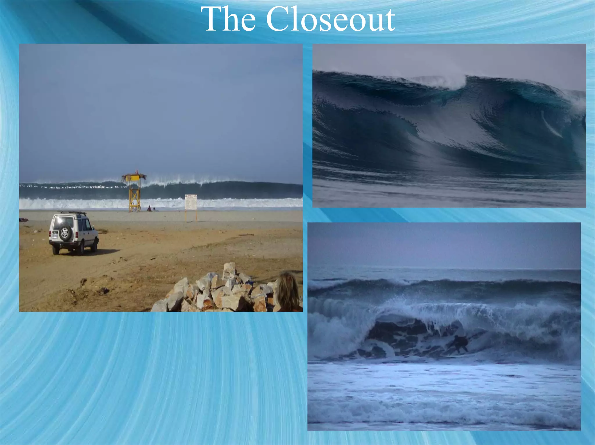 Tracheotomy - UCLA Head and Neck Surgery, ENT Ear, Nose & Throat ...