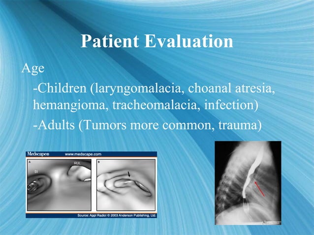 Tracheotomy - UCLA Head and Neck Surgery, ENT Ear, Nose & Throat ...