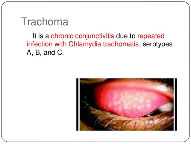 Trachoma