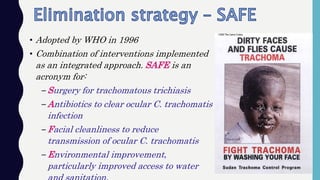 Trachoma | PPTX