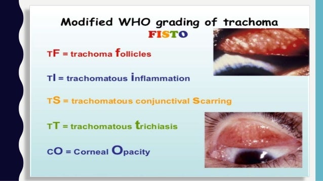 Trachoma