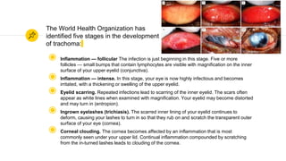 Trachoma | PPT