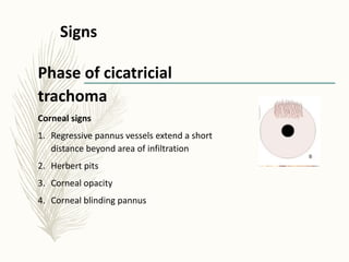 Trachoma | PPTX