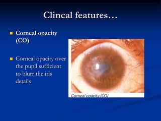 Trachoma.pptx