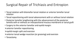 Trachoma of human eye for certificate nurses | PPTX | Eye and Vision ...
